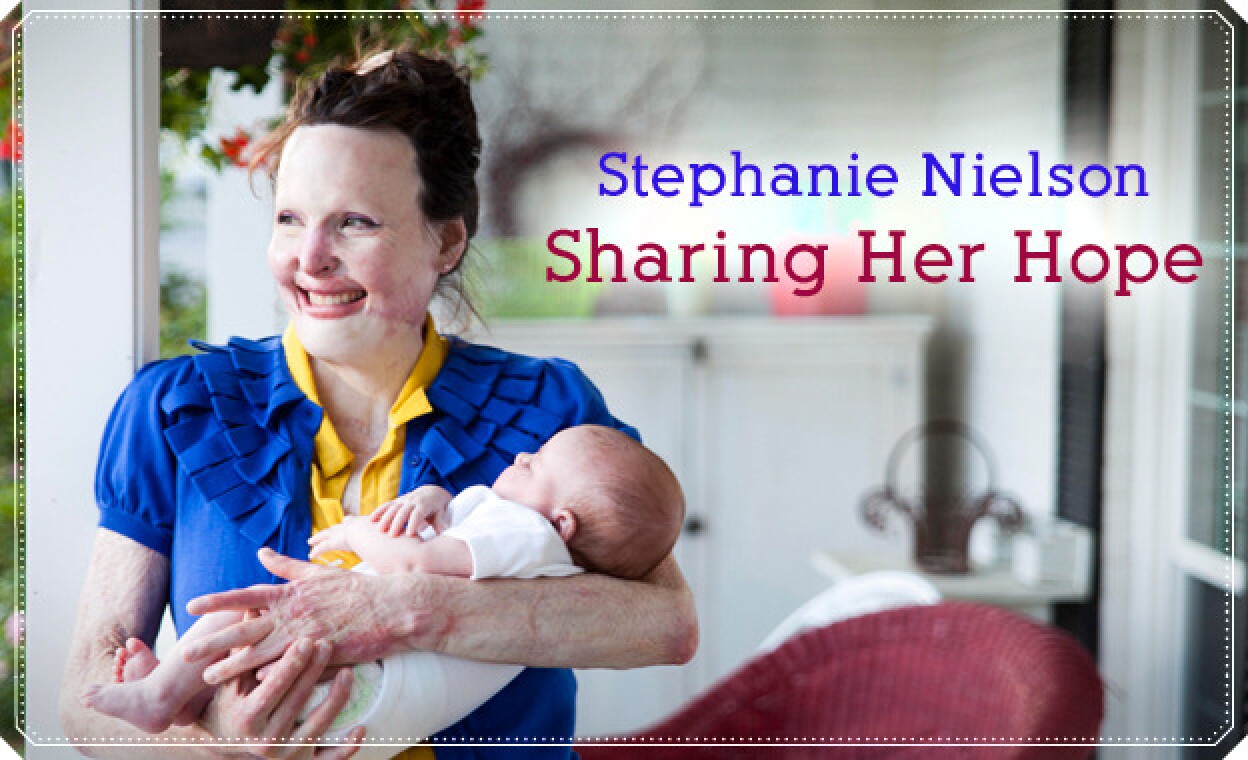 Stephanie Nielson Of Nienie Dialogues Sharing Her Hope Lds Living